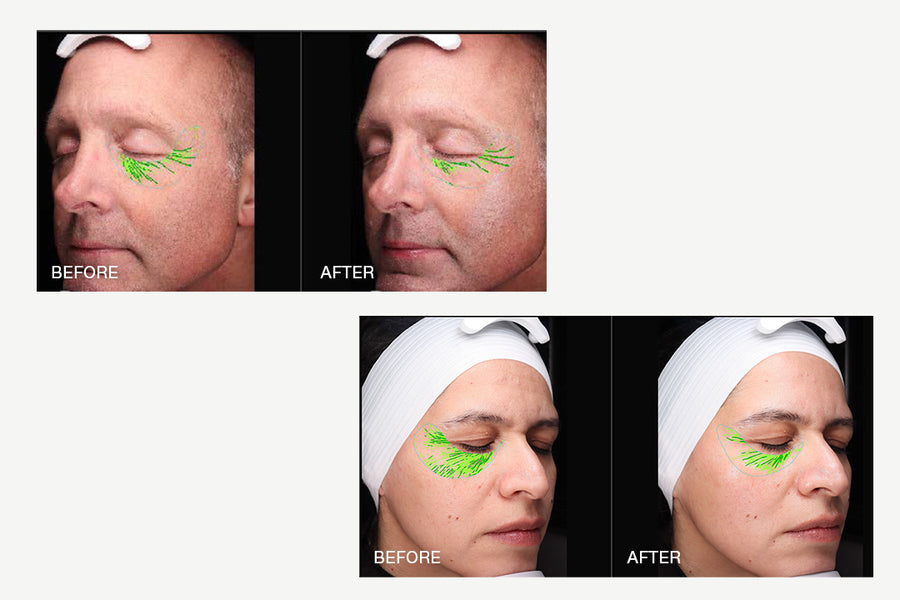 bt-sculpt GEN2 – Bio-Therapeutic